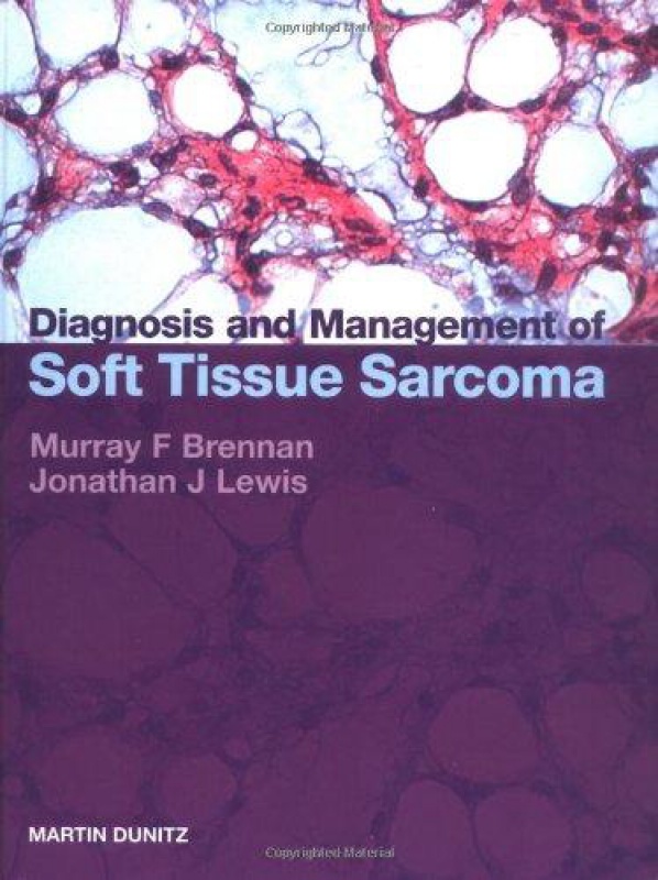 Diagnosis and Management of Soft Tissue Sarcoma (9781901865141 ...