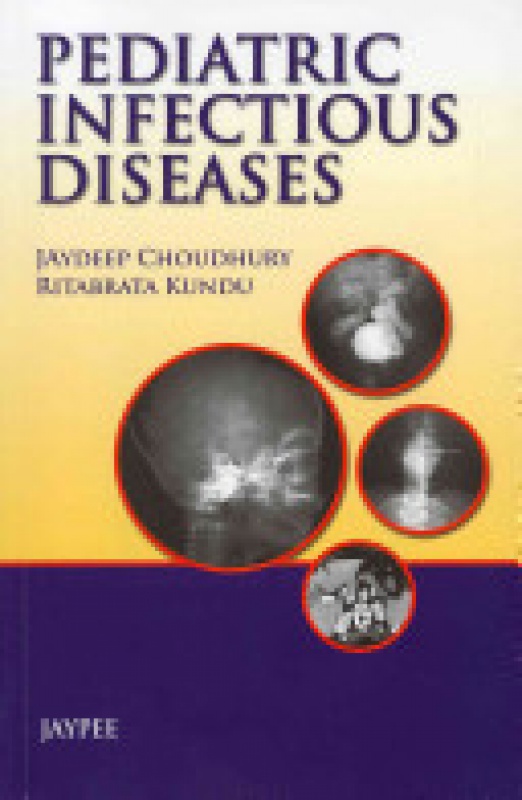 Pediatric Infectious Diseases (9789350259665) : Jaydeep Choudhury,Ritabrata Kundu | Malé centrum