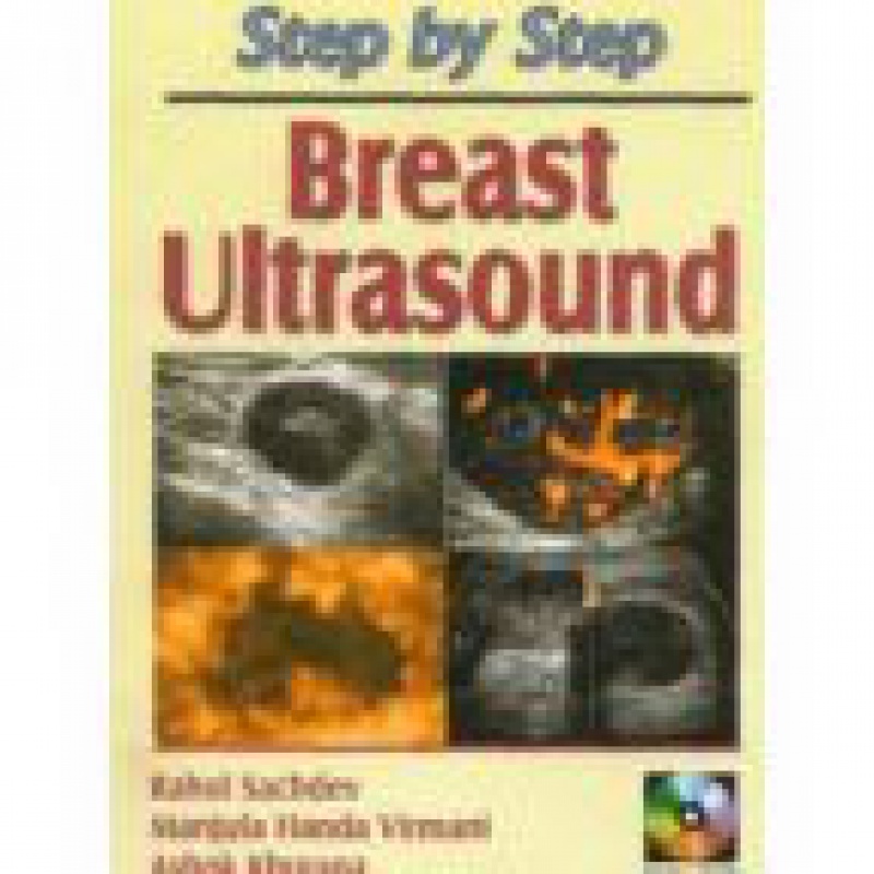 Step by Step: Breast Ultrasound (1904798799) : Sachdev R. | Malé centrum